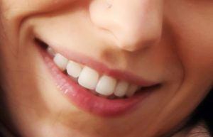 ¿Qué ocurre cuando se pierde una muela y no se sustituye? | Clínica ...